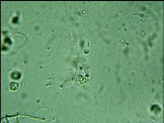 Microgallery.ro - Amiba